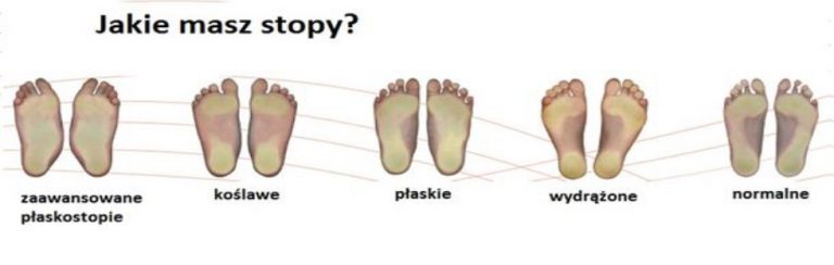 Zdrowa stopa – na co uważać i jak ćwiczyć - Akademia NFZ